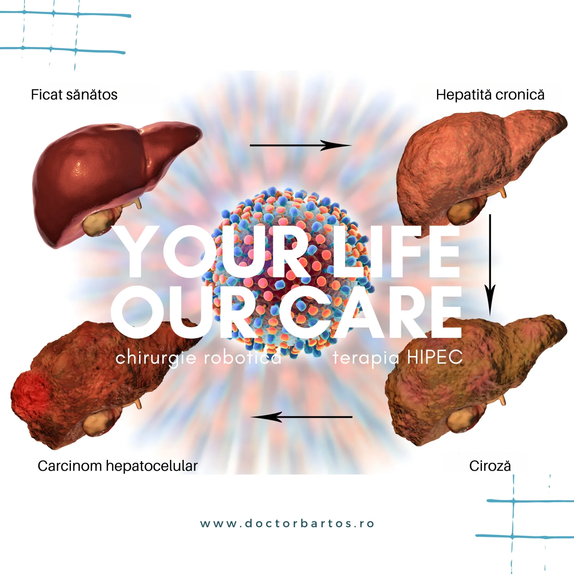 Totul despre cancerul hepatic - Informații de la Doctor Bartos